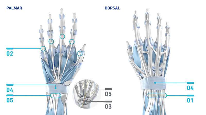 Hand and Wrist Therapy